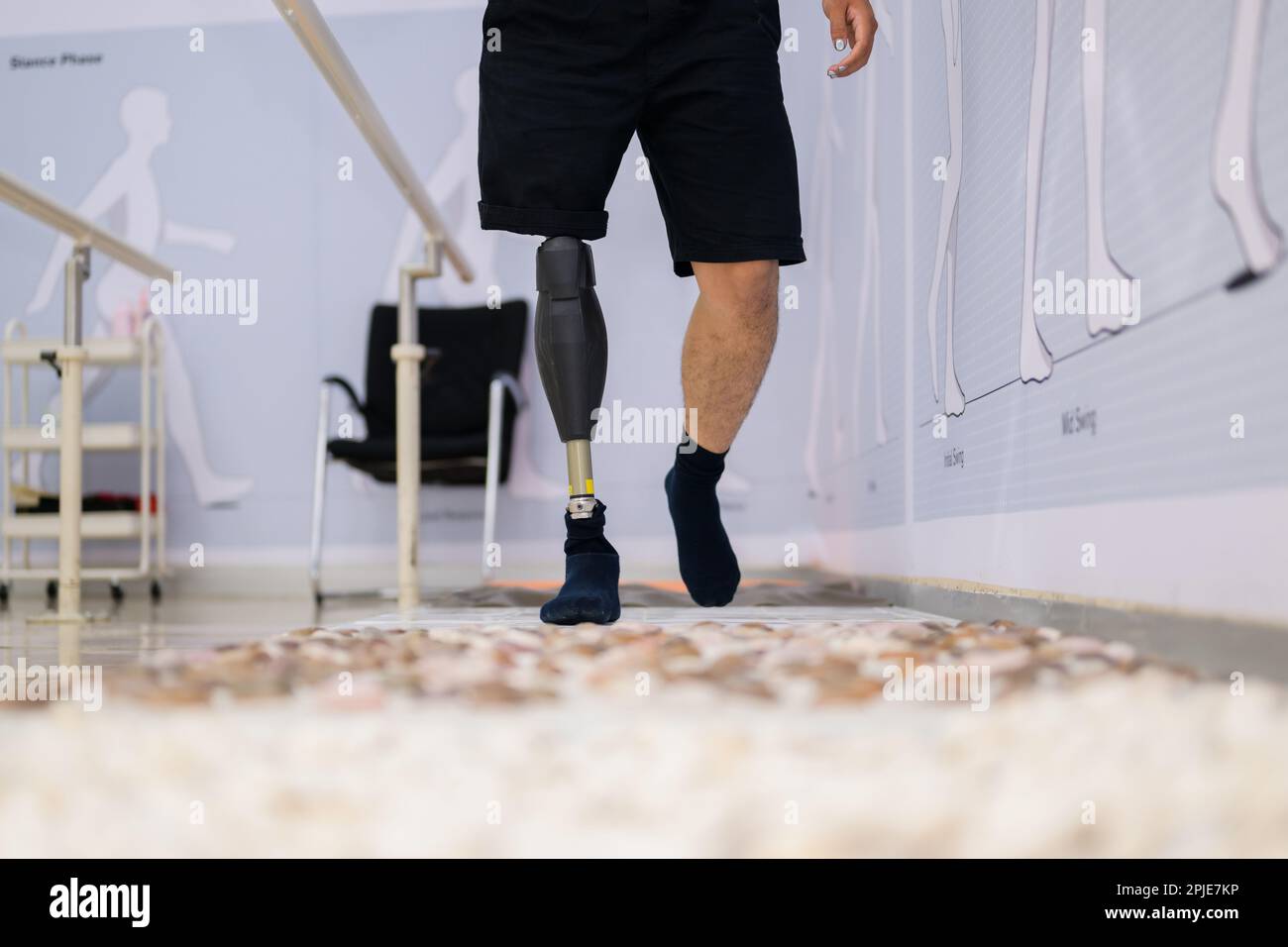 Athlete man with prosthetic leg walking at health care center Stock ...