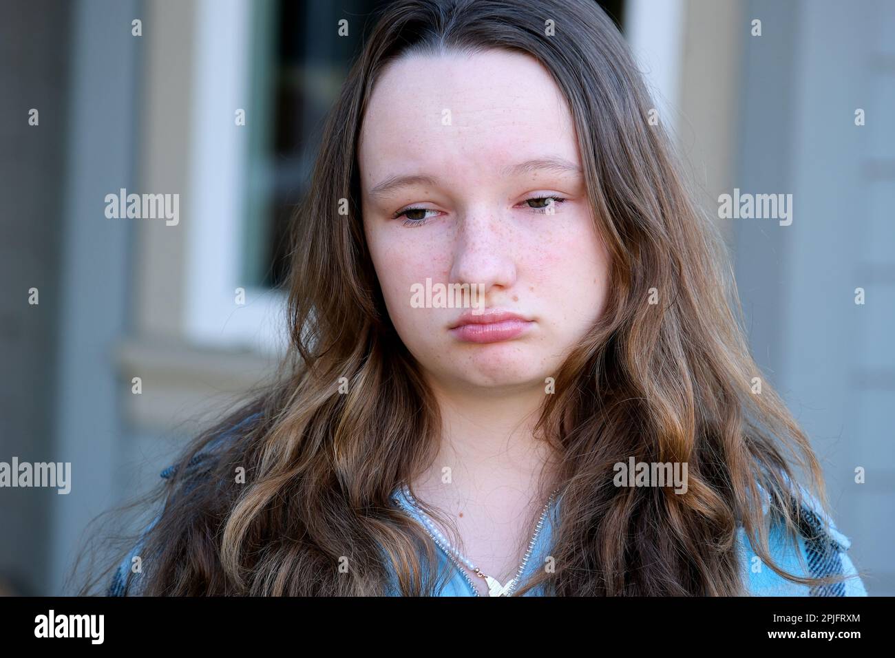 sad face of beautiful girl crying under puffy eyes light allergy ...