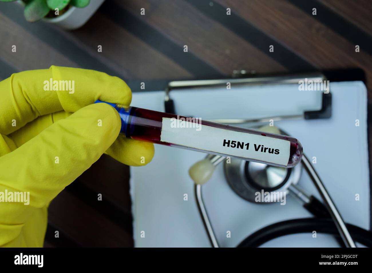 Concept of H5N1 - Test with blood sample. Healthcare or medical concept ...