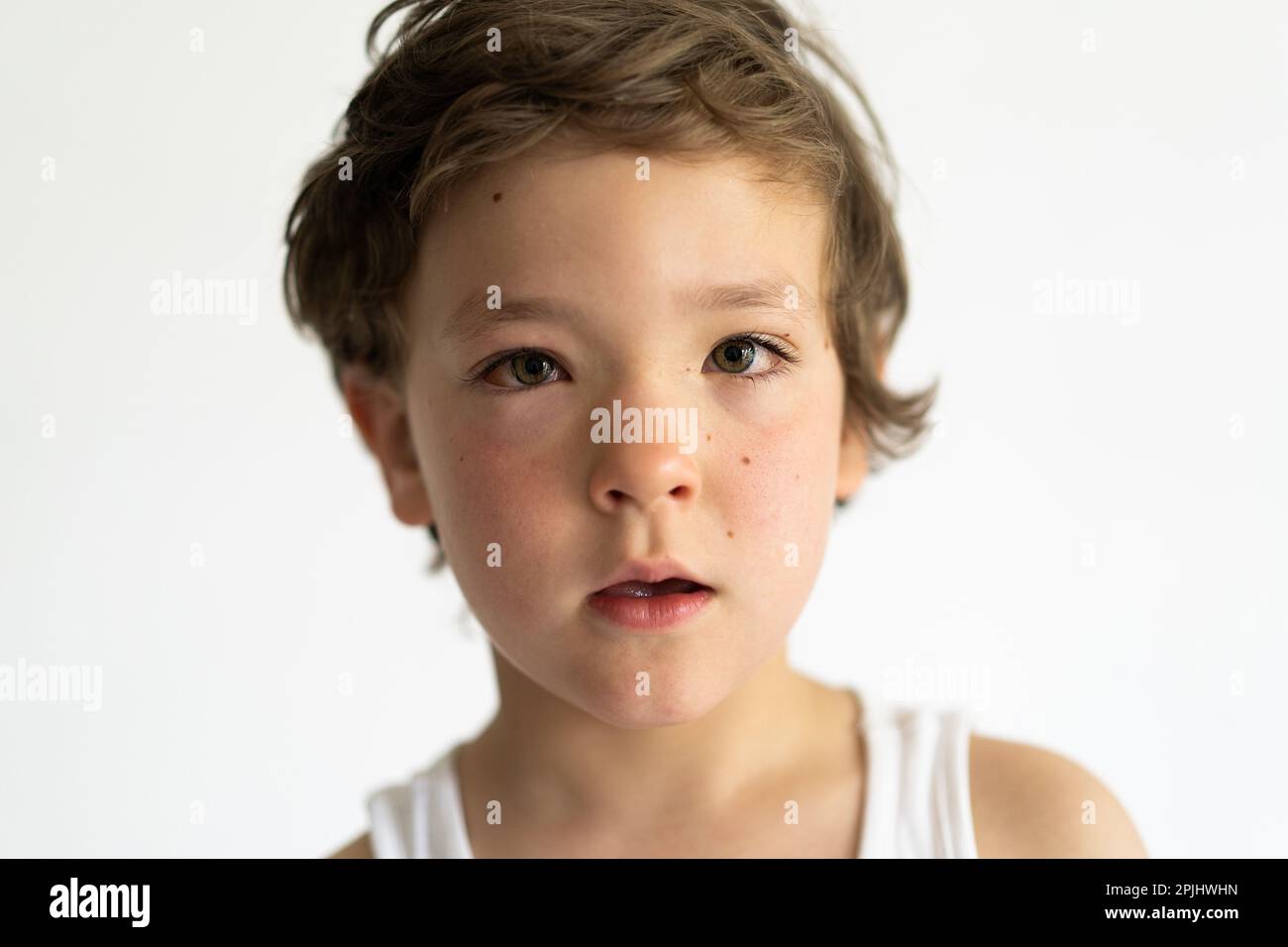 The boy was swollen from allergies. Allergy from pollen or food Stock ...