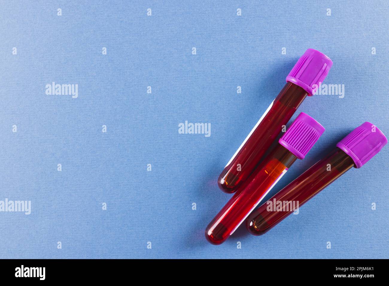 Three blood sample tubes with purple lids, on blue background with copy ...
