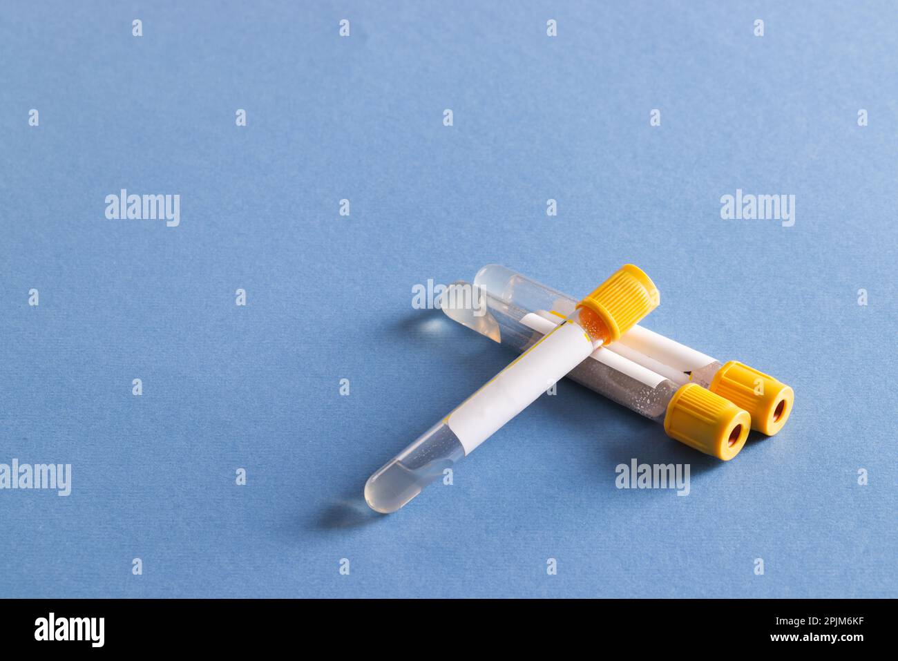 Three sample tubes of clear fluid with yellow lids, on blue background ...