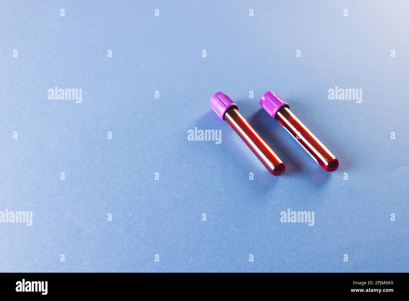 Two blood sample tubes with purple lids, on blue background with copy ...