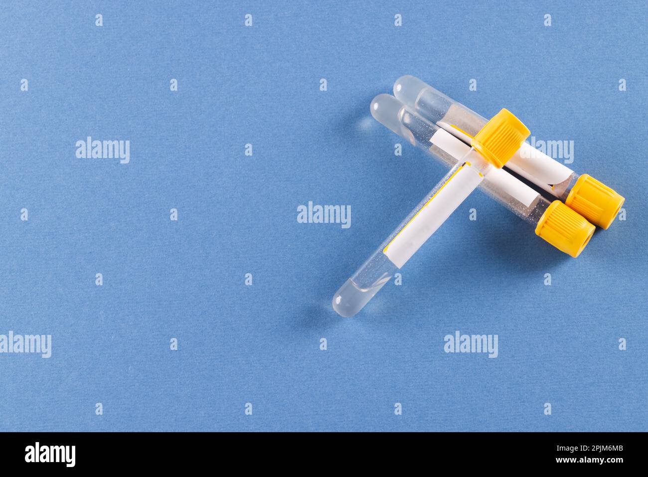 Three sample tubes of clear fluid with yellow lids, on blue background ...