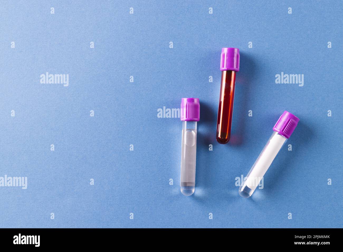Three sample tubes with purple lids, one containing blood, on blue ...