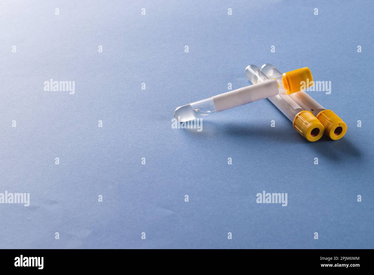 Three sample tubes of clear fluid with yellow lids, on blue background ...