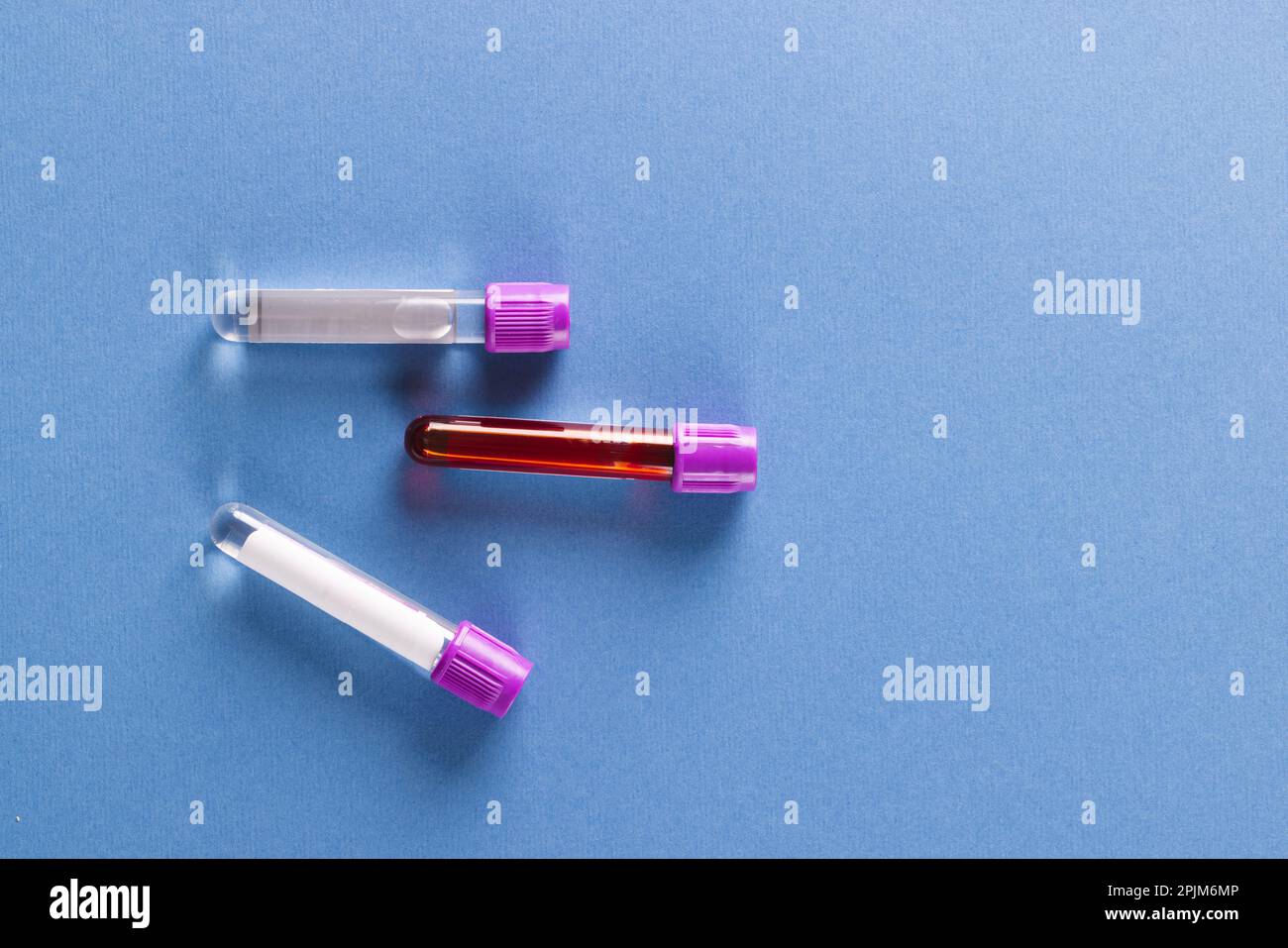 Three sample tubes with purple lids, one containing blood, on blue ...