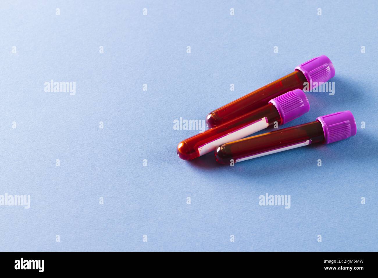 Three blood sample tubes with purple lids, on blue background with copy ...
