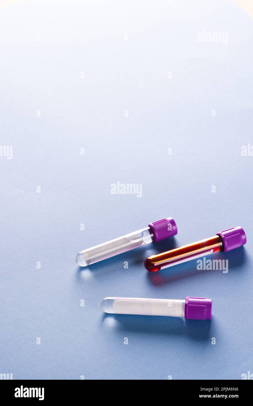 Three sample tubes with purple lids, one containing blood, on blue ...
