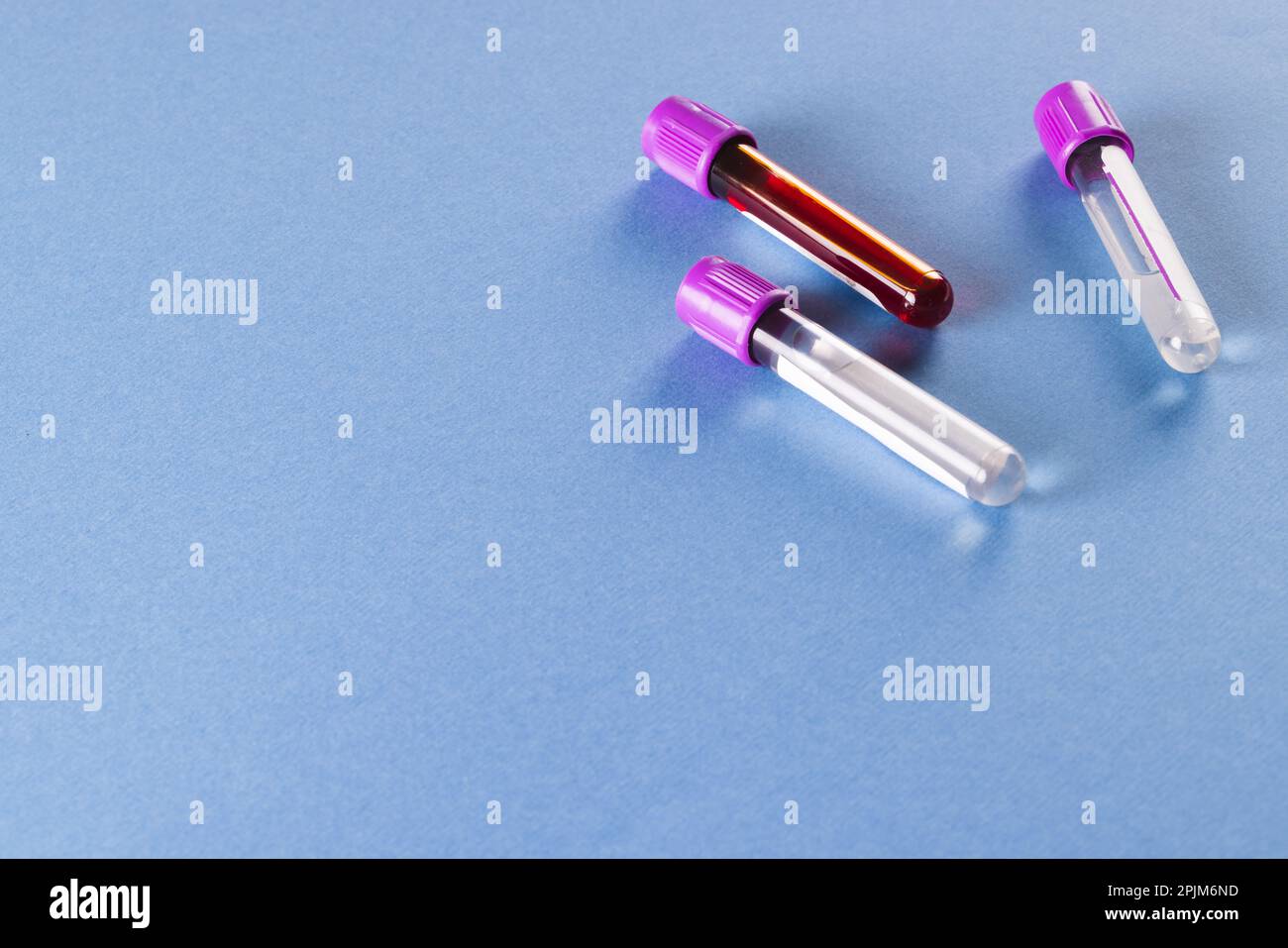 Three sample tubes with purple lids, one containing blood, on blue ...