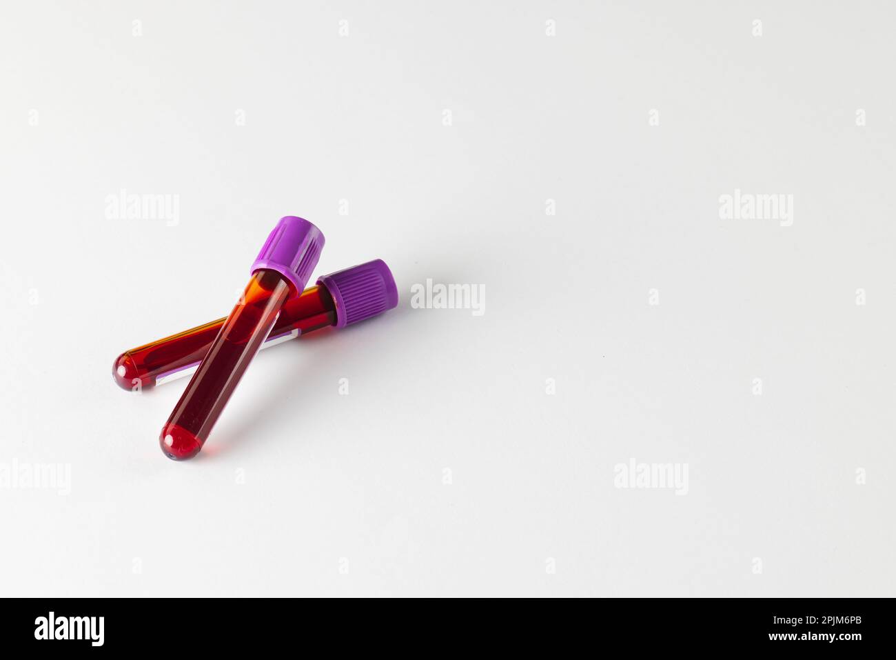 Two blood sample tubes with purple lids, on white background with copy ...