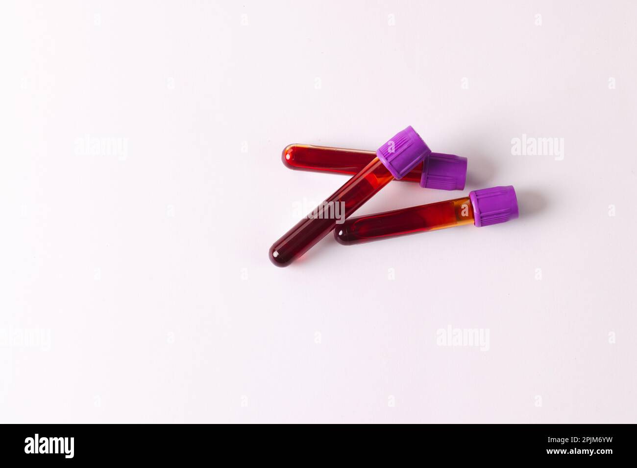 Three blood sample tubes with purple lids, on white background with ...