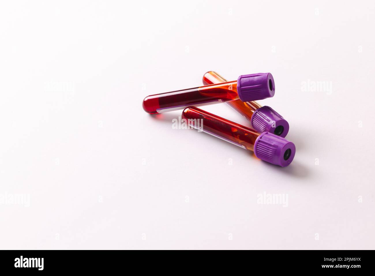 Three blood sample tubes with purple lids, on white background with ...
