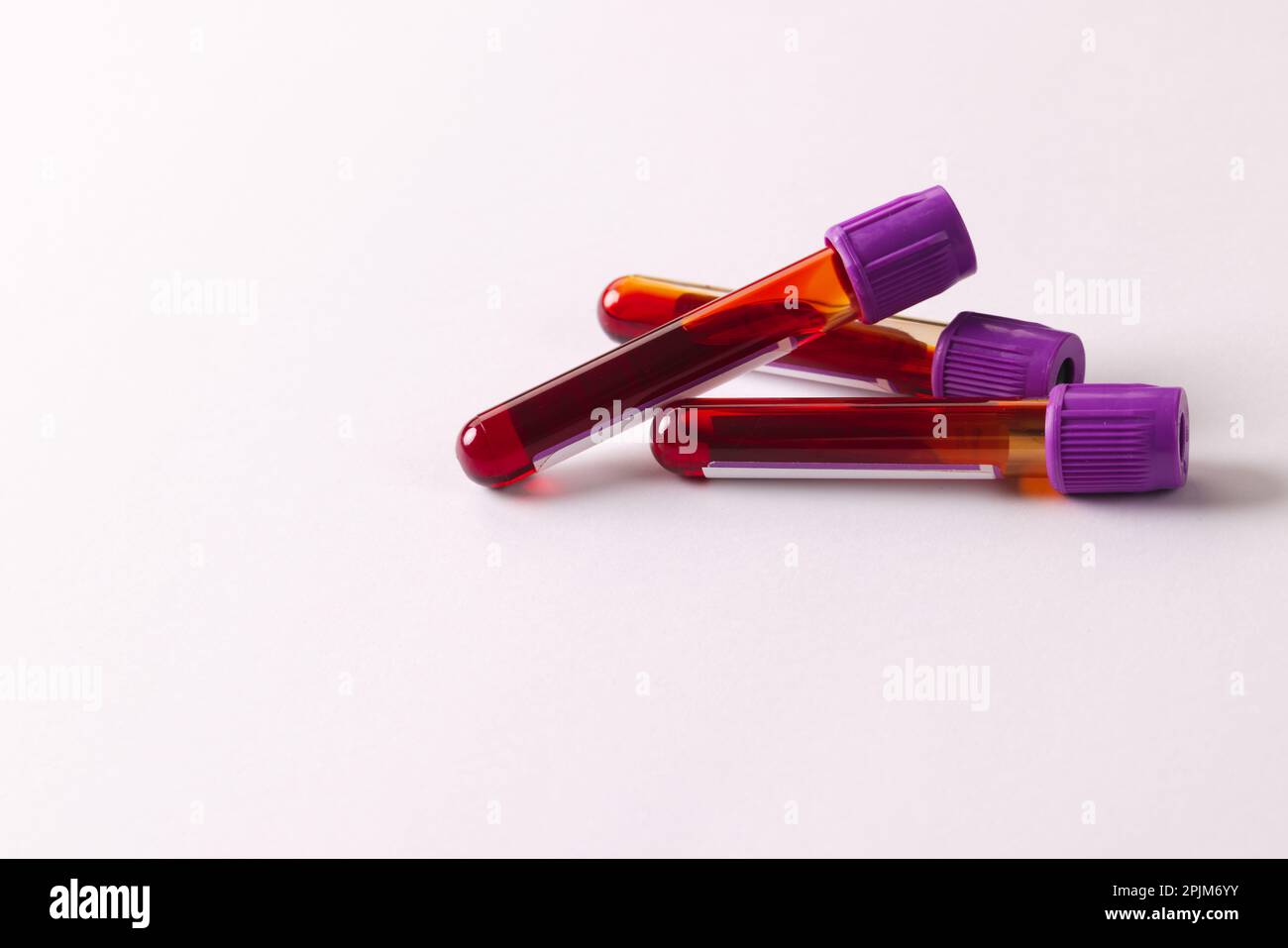 Three blood sample tubes with purple lids, on white background with ...
