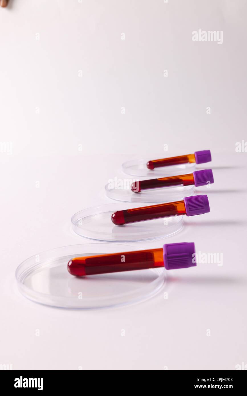 Row of blood sample tubes in petri dishes, on white background with ...