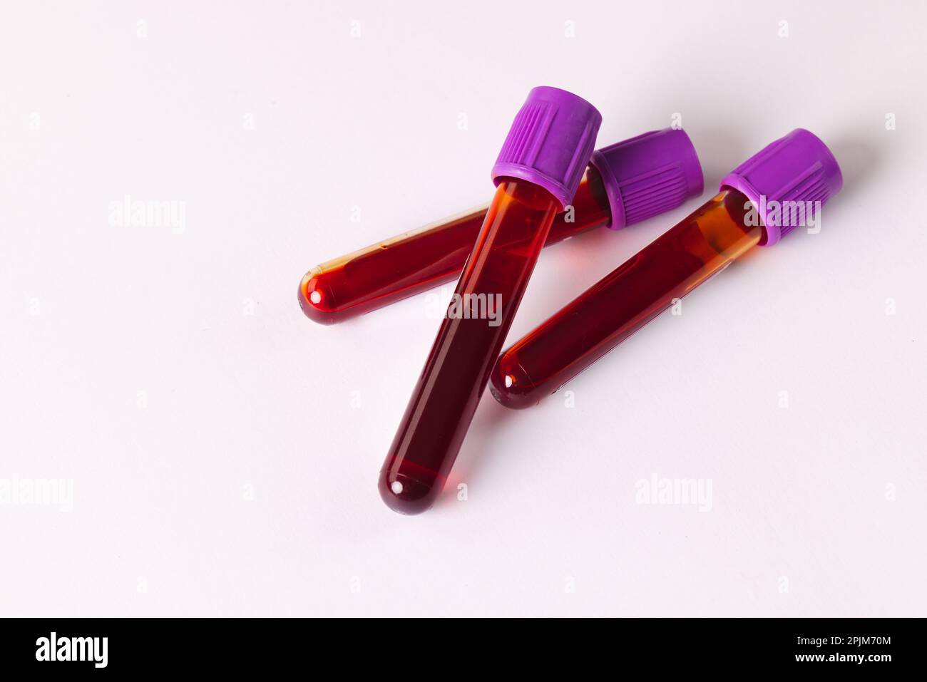 Three blood sample tubes with purple lids, on white background Stock ...