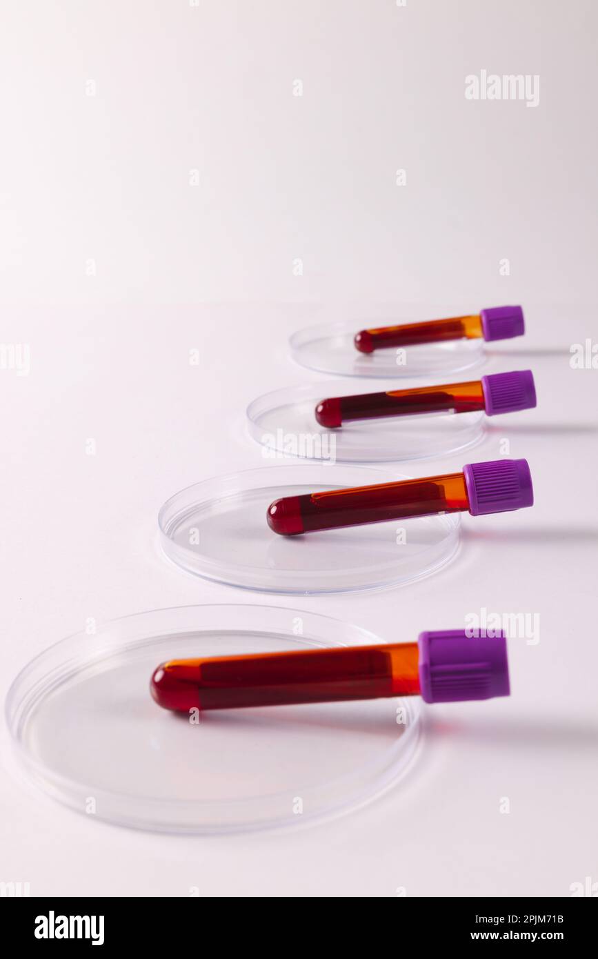 Row of blood sample tubes in petri dishes, on white background with ...