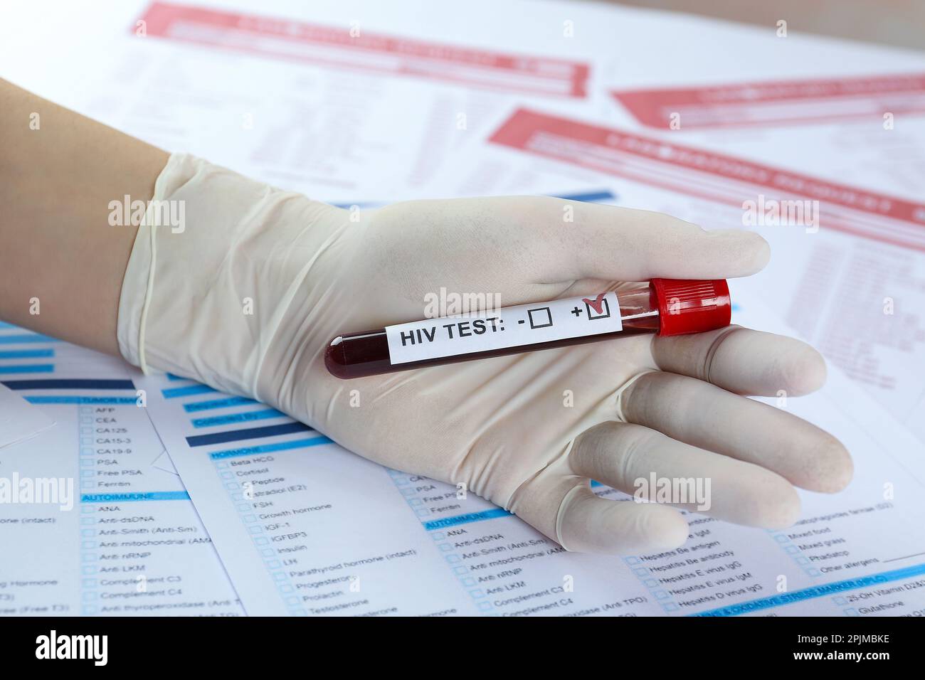 Scientist holding tube with blood sample and label HIV Test against ...