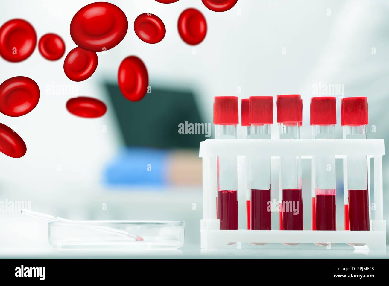 Capillary blood tubes hi-res stock photography and images - Alamy
