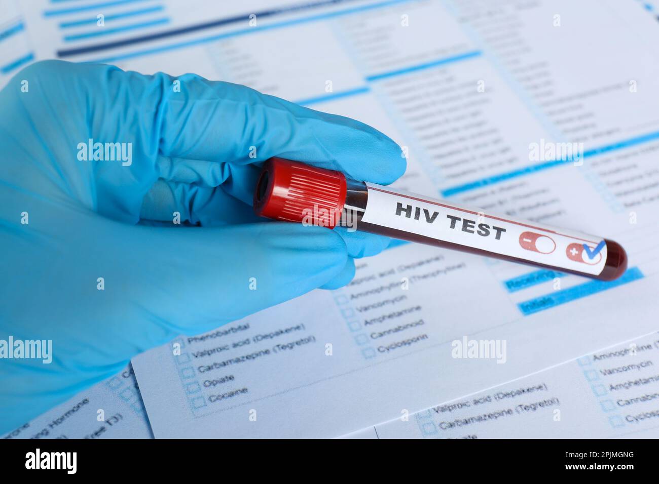 Scientist holding tube with blood sample and label HIV Test against ...