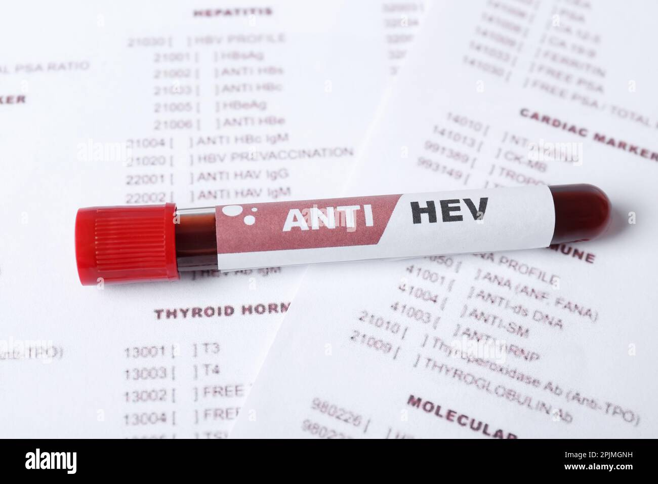 Tube with blood sample and label ANTI HEV on laboratory test form ...