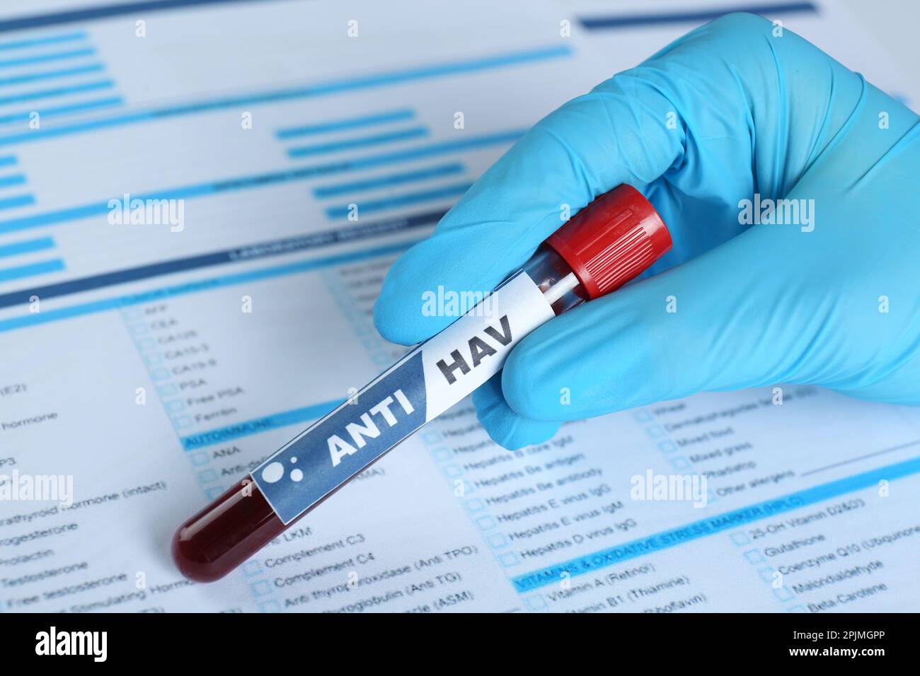 Scientist holding tube with blood sample and label Anti HAV against ...