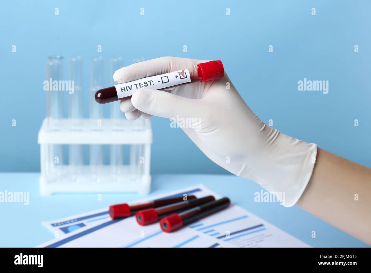 Scientist holding tube with blood sample and label HIV Test on light ...