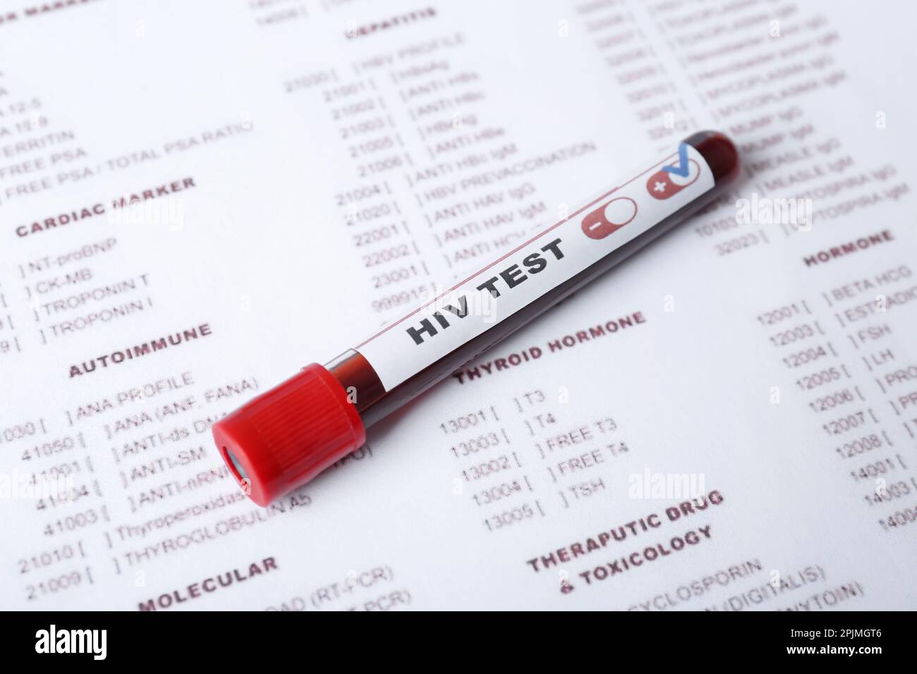 Tube with blood sample and label HIV TEST on laboratory form, closeup ...