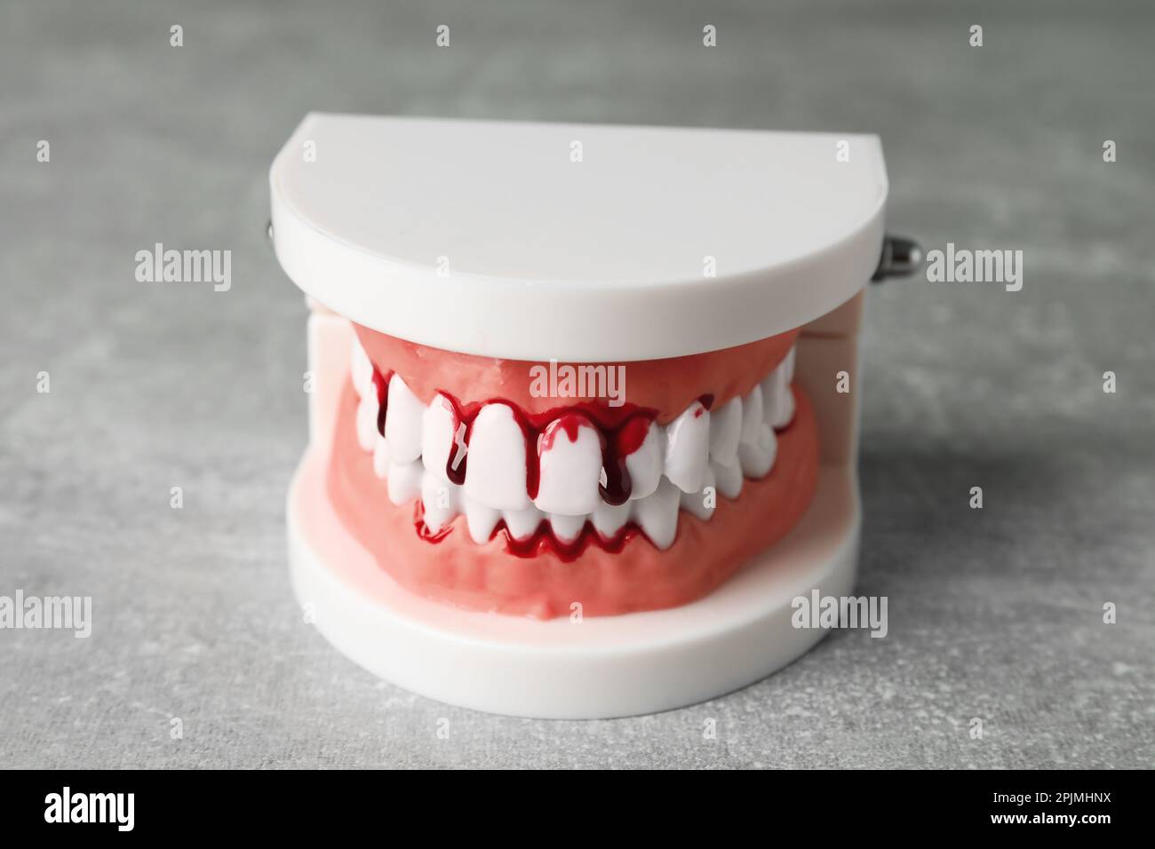 Model of jaw with blood on light grey table, closeup. Gum inflammation ...
