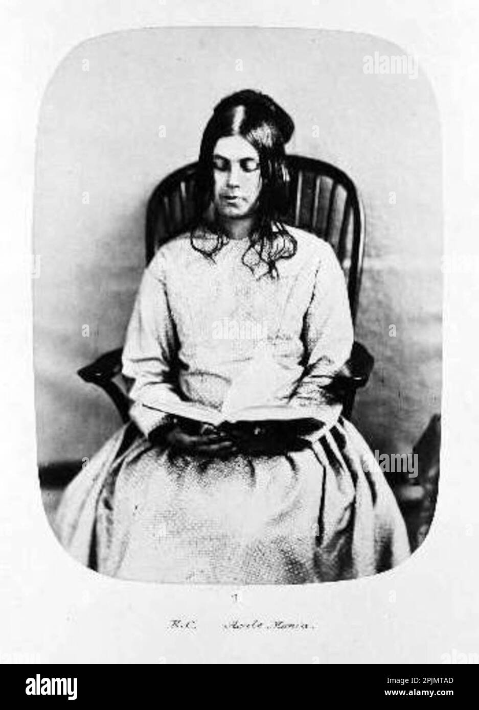 Acute mania hi-res stock photography and images - Alamy