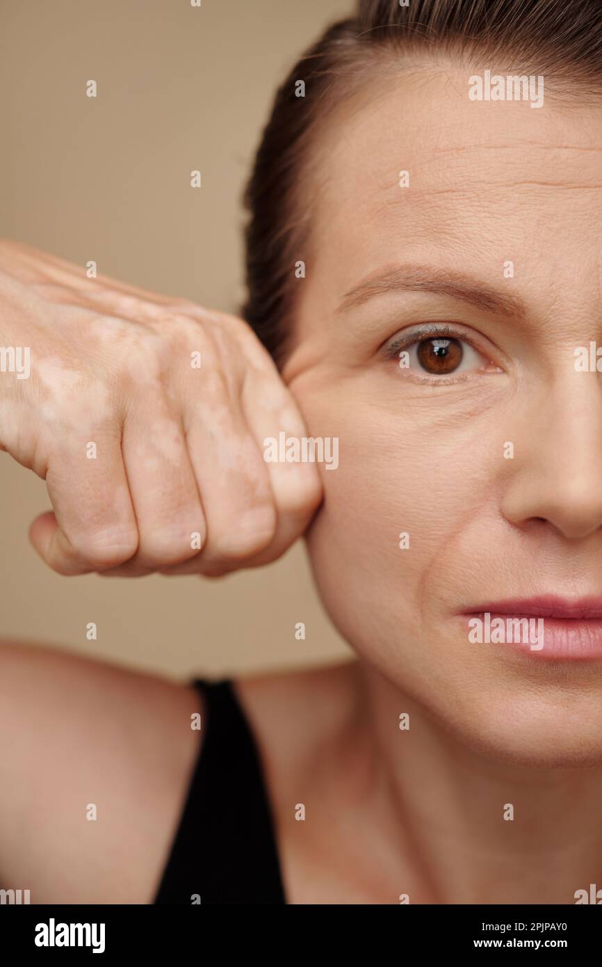 Face of mature woman pulling back skin of her face to get rid of ...