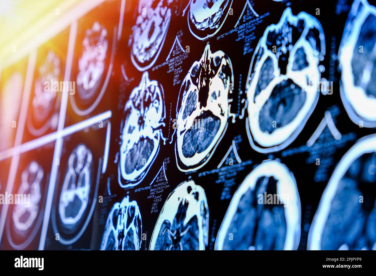 Close-up of CT scan with brain. Medicine, science and education MRI ...