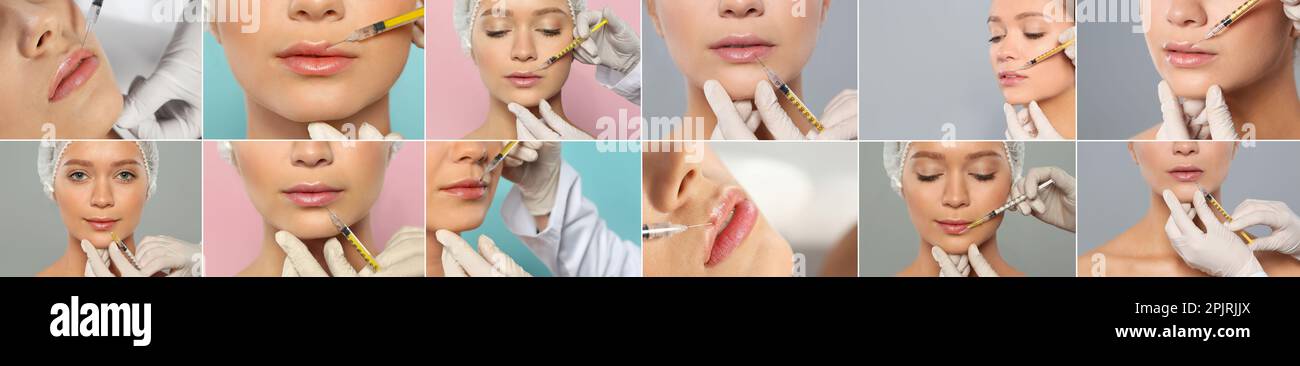 Augmentation procedure hi-res stock photography and images - Alamy