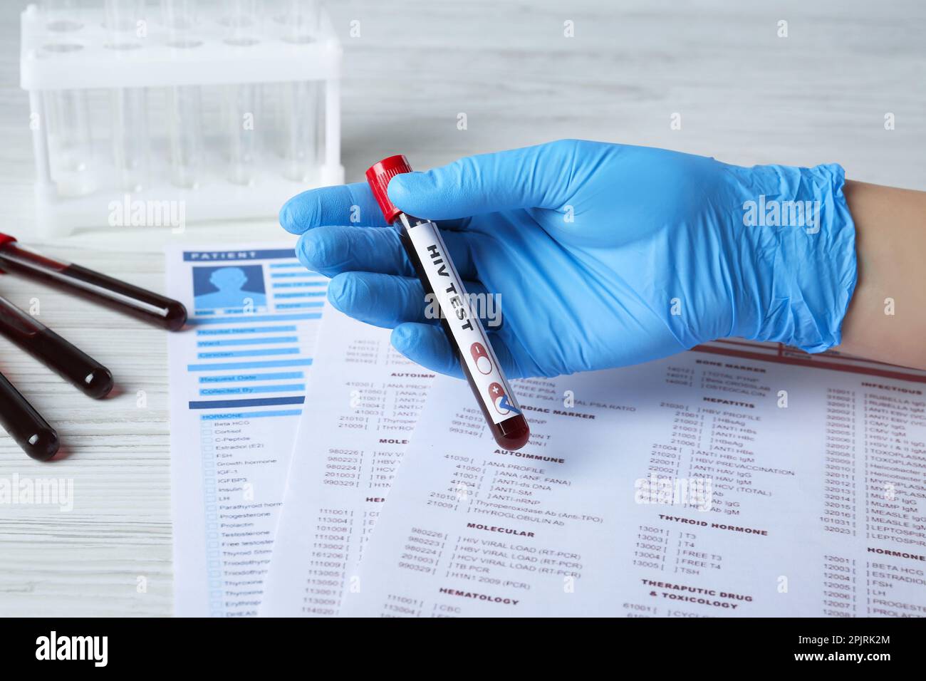 Scientist holding tube with blood sample and label HIV Test near ...