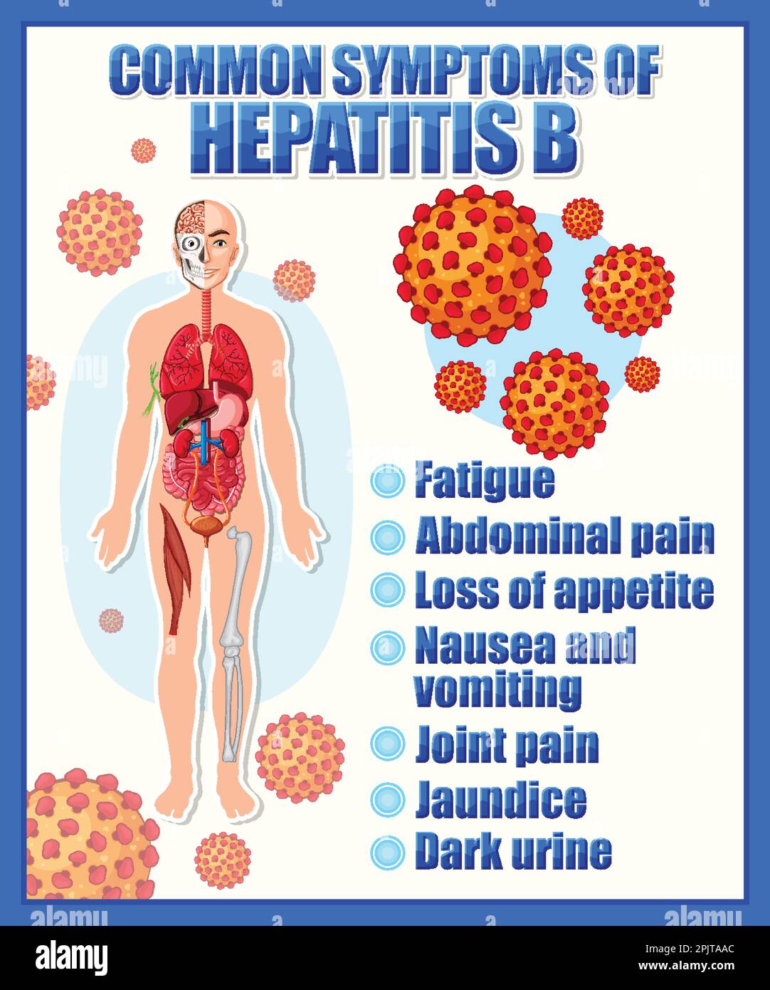 Informative poster of common symptoms Hepatitis B illustration Stock Vector Image & Art - Alamy