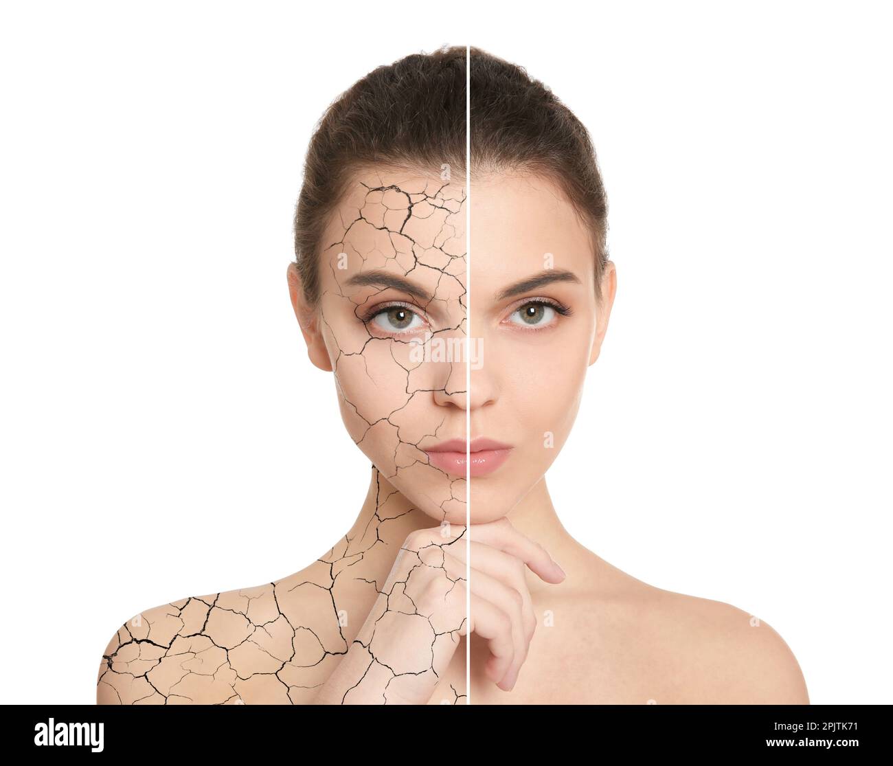 Collage with photos of woman having dry skin problem before and after ...