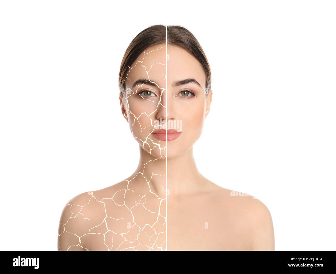 Collage with photos of woman having dry skin problem before and after ...