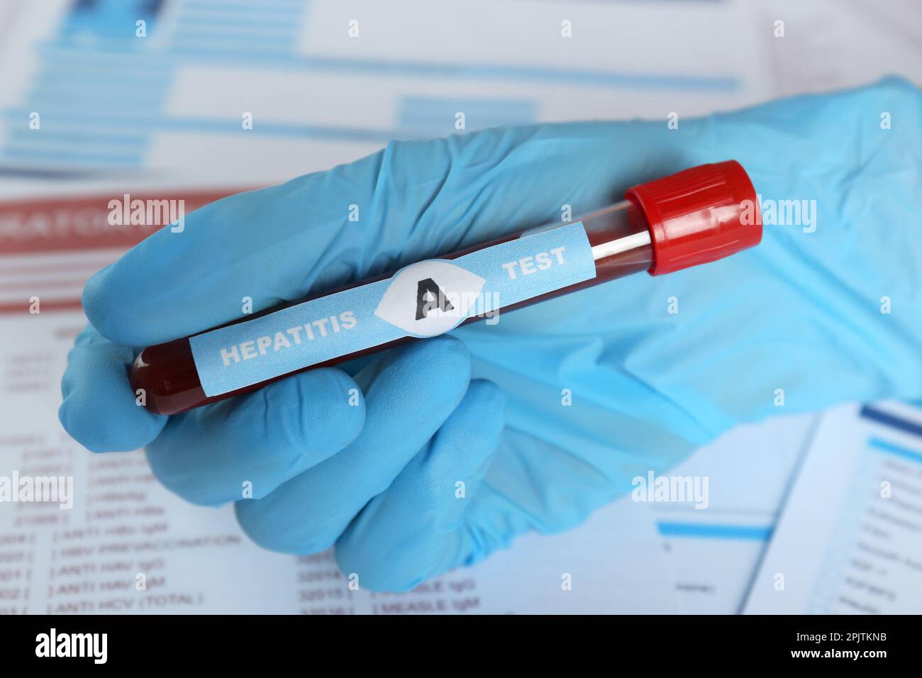 Scientist holding tube with blood sample and label Hepatitis A Test ...