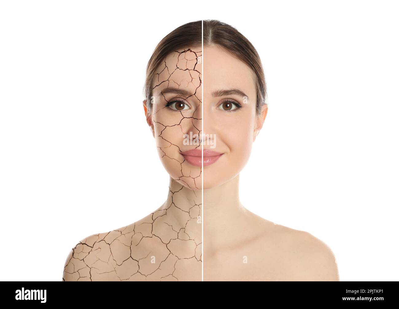 Collage with photos of woman having dry skin problem before and after ...