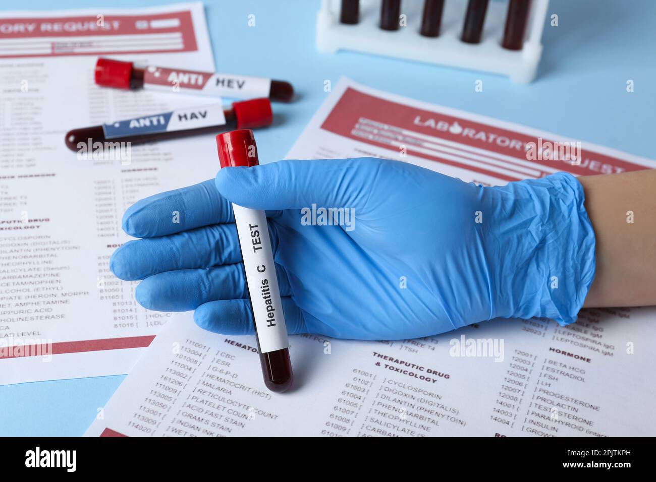 Scientist holding tube with blood sample and label Hepatitis C test ...