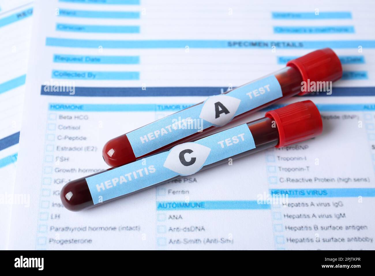 Tubes with blood samples for hepatitis virus test on laboratory form ...