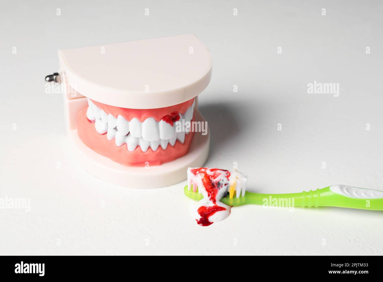 Toothbrush with paste and blood near jaw model on white table. Gum ...