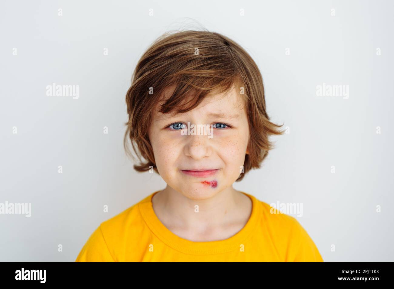 Portrait of school boy kid child crying due to sore bruised wound on ...