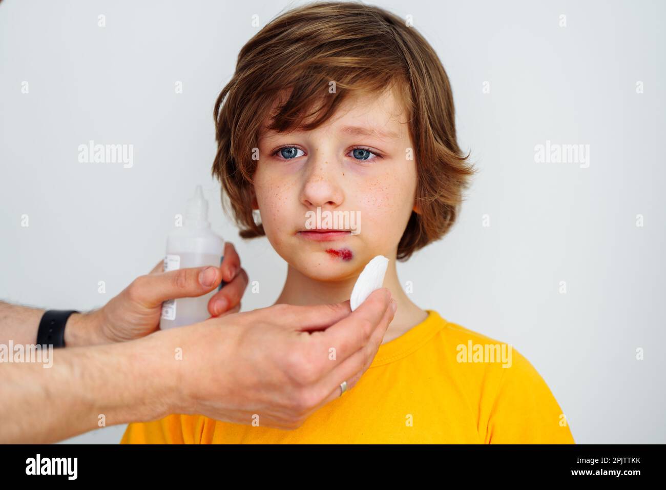 Dad doctor father treats bruised wound on his son school boy kid face ...