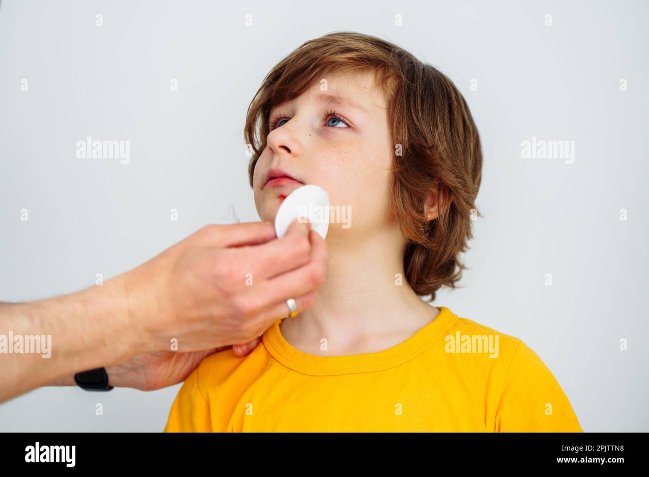 Dad doctor father treats bruised wound on his son school boy kid face ...