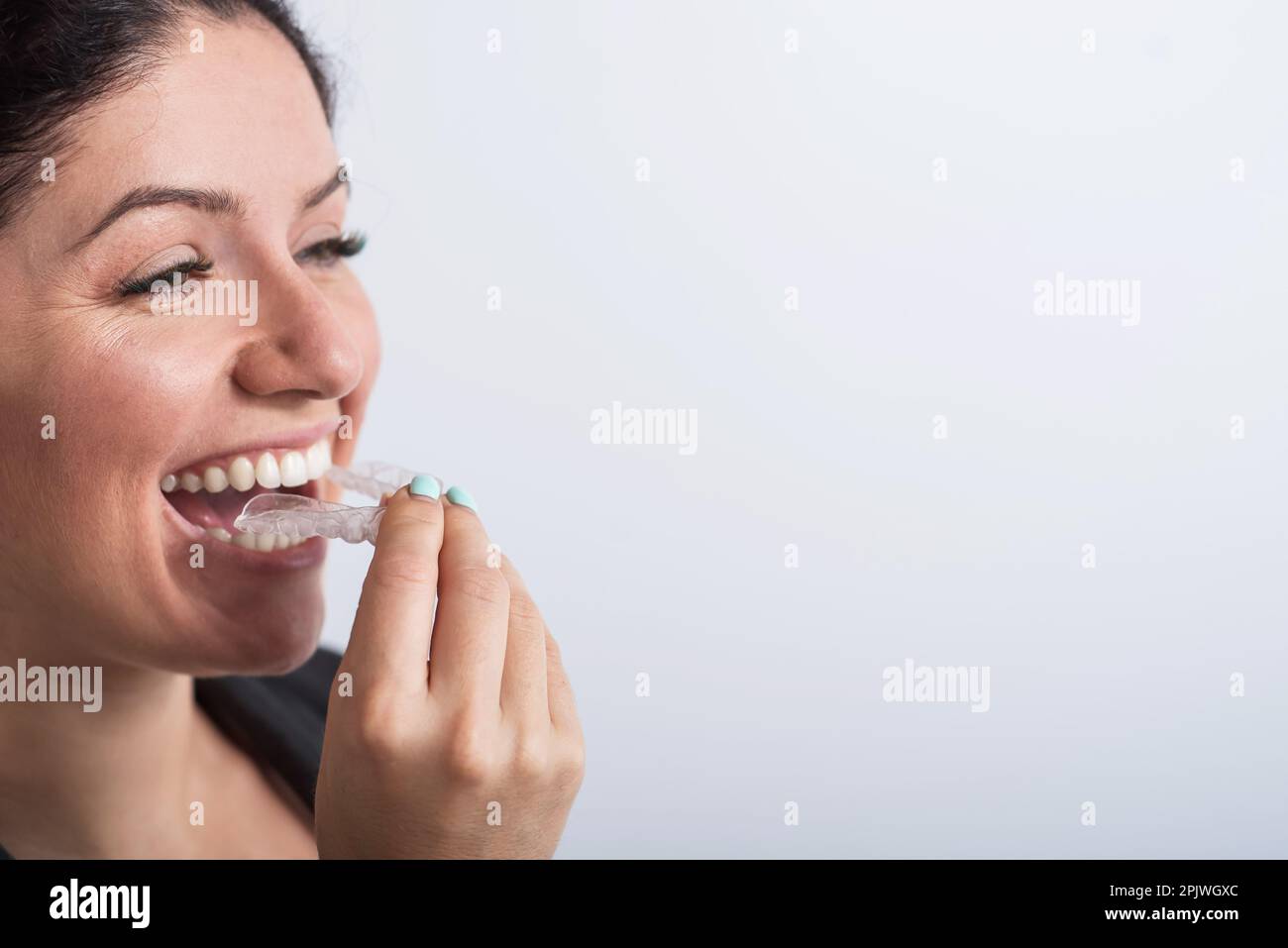 A woman uses transparent retainers to whiten teeth Stock Photo - Alamy