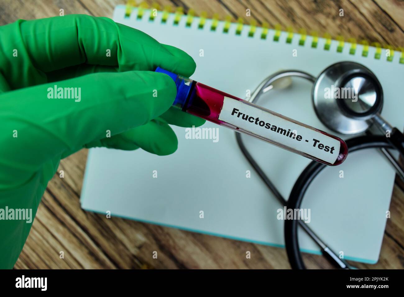 Concept of Fructosamine - Test with blood sample. Healthcare or medical ...