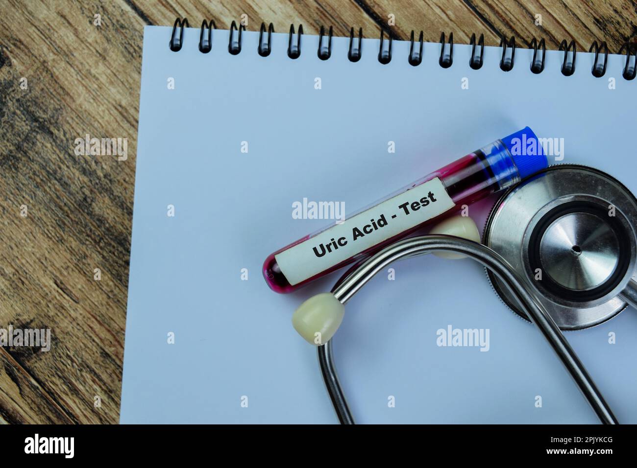 Concept of Uric Acid - Test with blood sample. Healthcare or medical ...