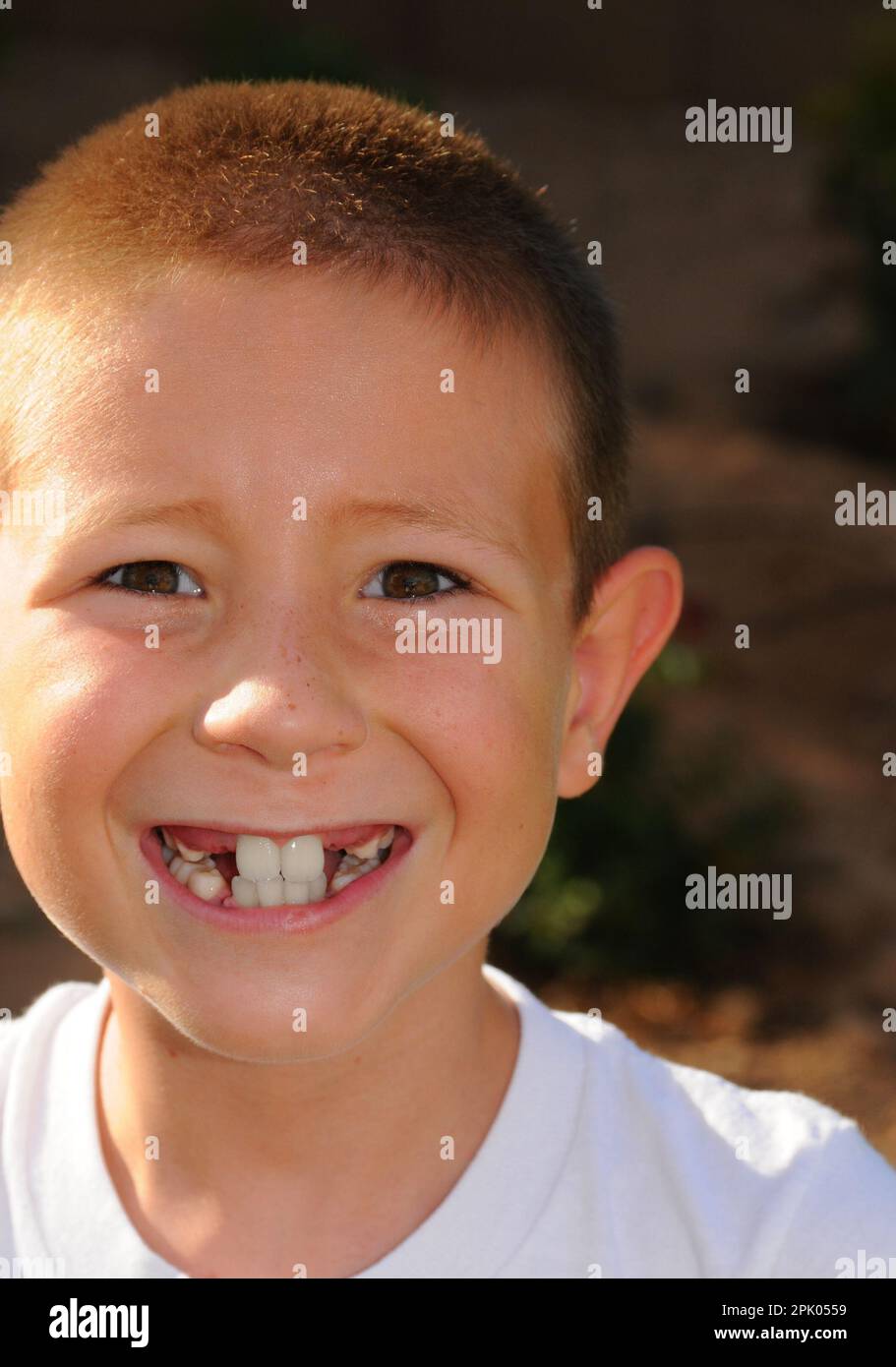 Young boy with only his two front teeth Stock Photo - Alamy