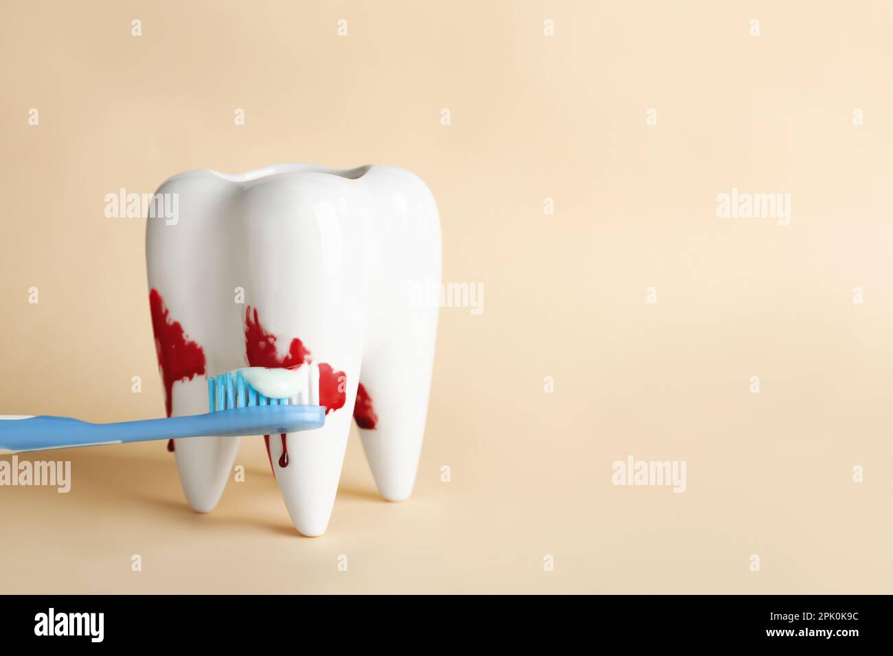 Tooth model, brush and blood in toothpaste foam on beige background ...